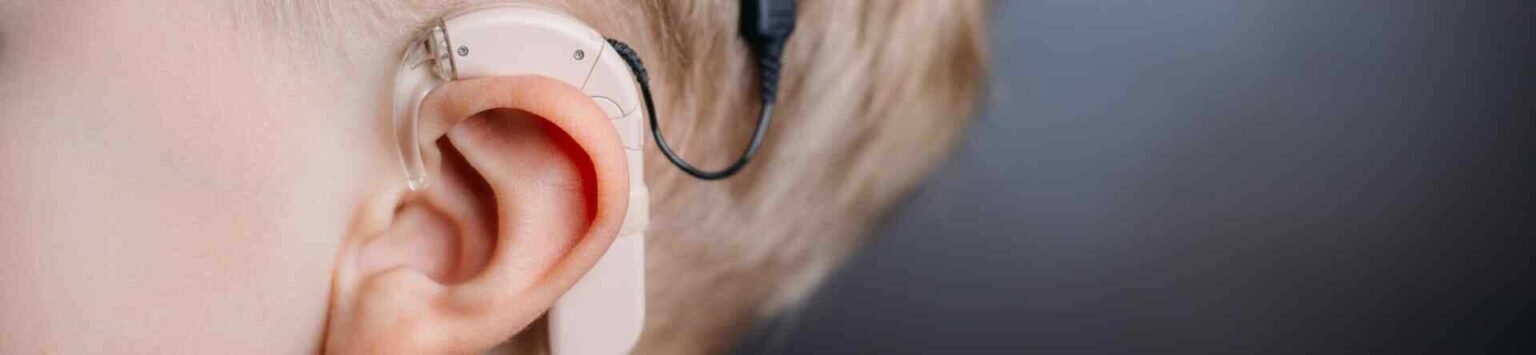 What is a Cochlear Implant? - Europe Medical Healthcare Academy